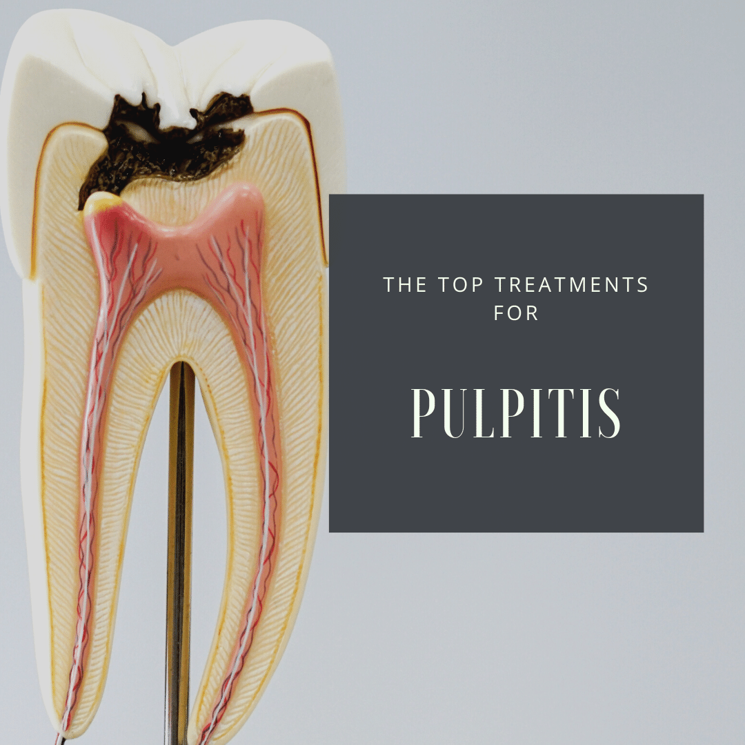 The Top Treatments for Pulpitis - Empire Dental